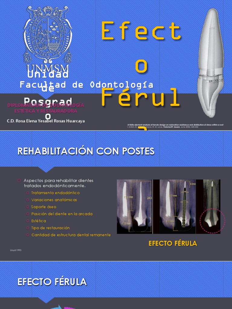 Efecto Ferula en Endopostes | Titanio | Odontología