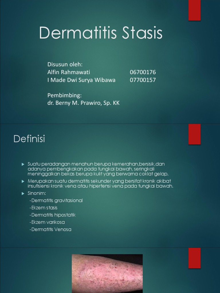 Dermatitis Stasis | PDF | Sains & Matematika