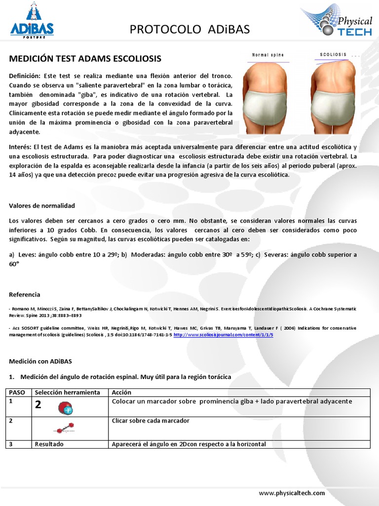 Test Adams | PDF | Escoliosis | Especialidades Medicas