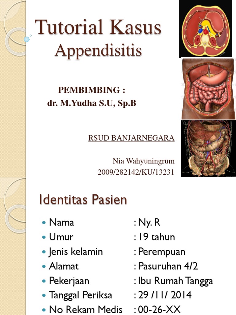 Tutorial Kasus: Appendisitis | PDF