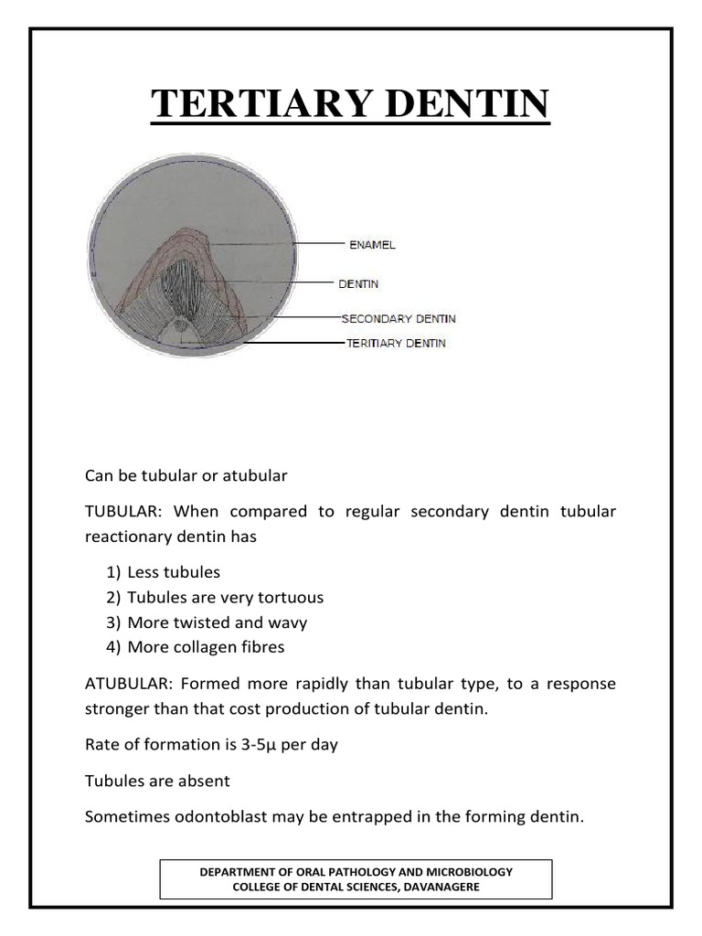 Tertiary Dentin | PDF