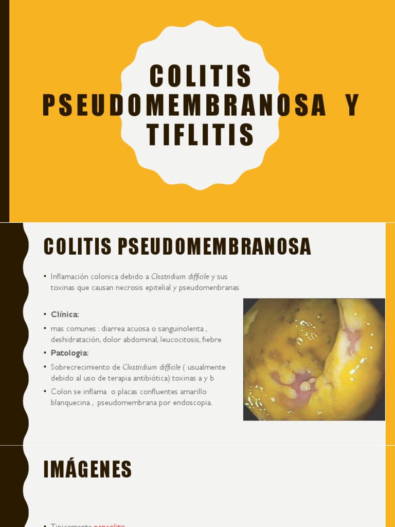 Colitis Pseudomembranosa y Tiflitis | PDF | Enfermedad de Crohn ...