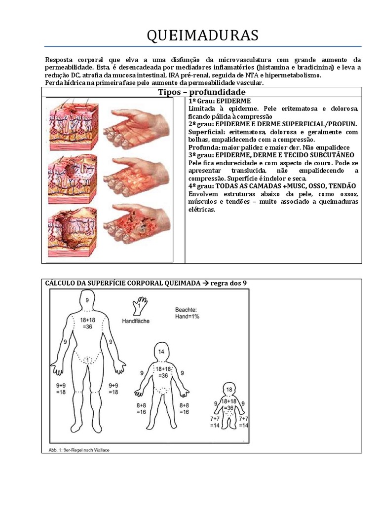 QUEIMADURAS.pdf | Queimadura | Pele