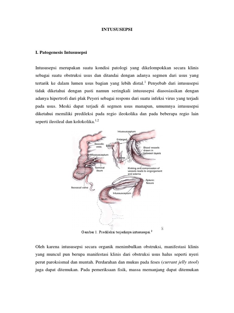 Tinpus Anatomi Intususepsi | PDF