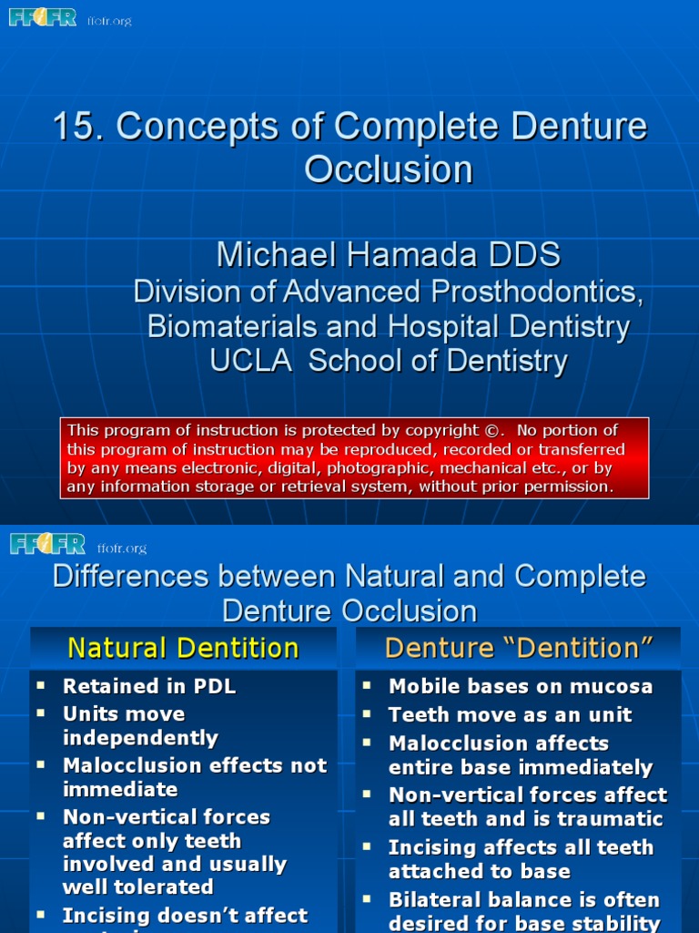 Concepts of Complete Denture Occlusion | PDF | Dentures | Mouth