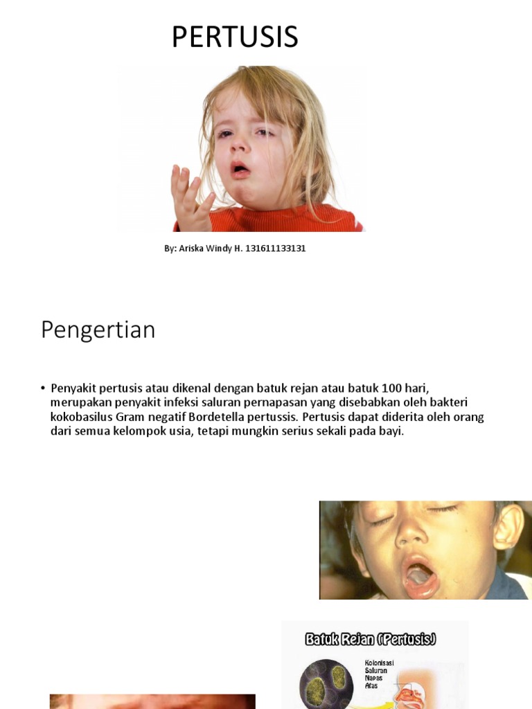 Pertusis | PDF