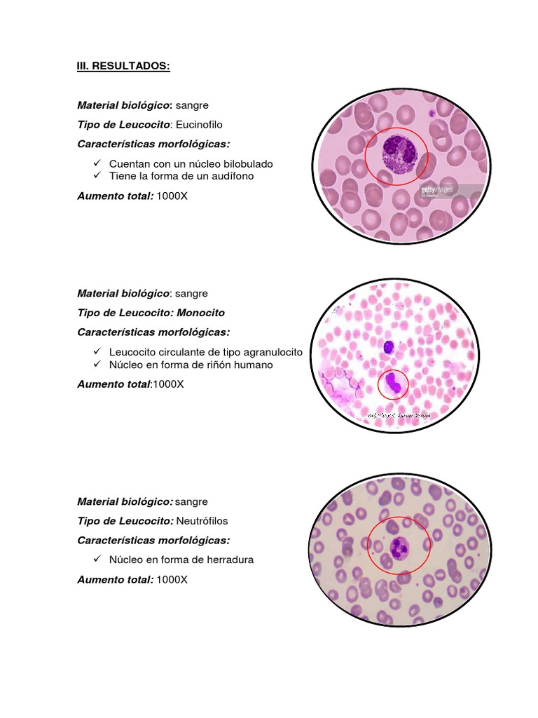 Celulas Del Sistema Inmunitario | PDF | Leucocito | Biología