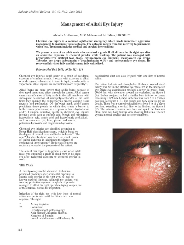 Management of Alkali Eye Injury: Abdulla A. Almoosa, MD Muhammad Atif ...