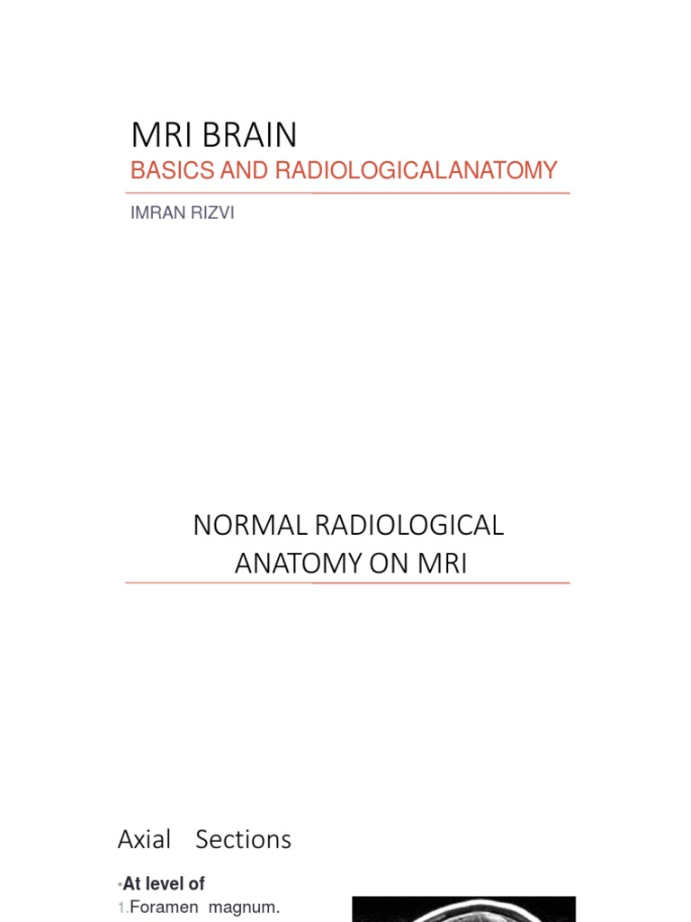 Mri Brain: Basics and Radiologicalanatomy | PDF | Magnetic Resonance ...