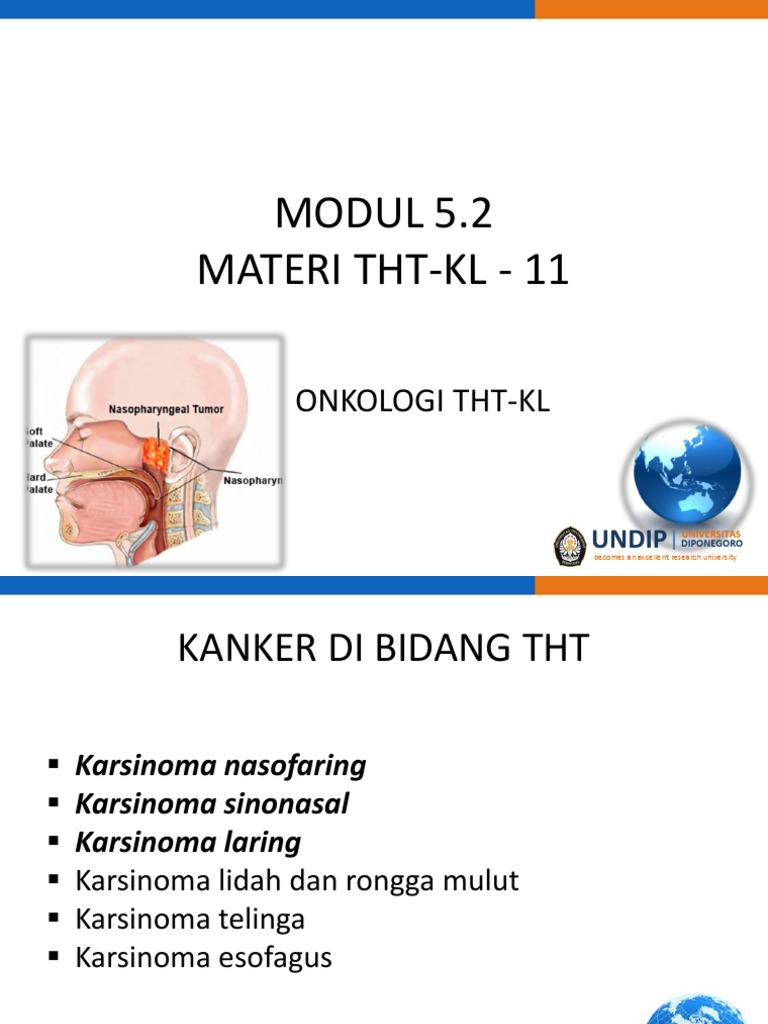 Onkologi THT - Modul 5.2 PDF | PDF