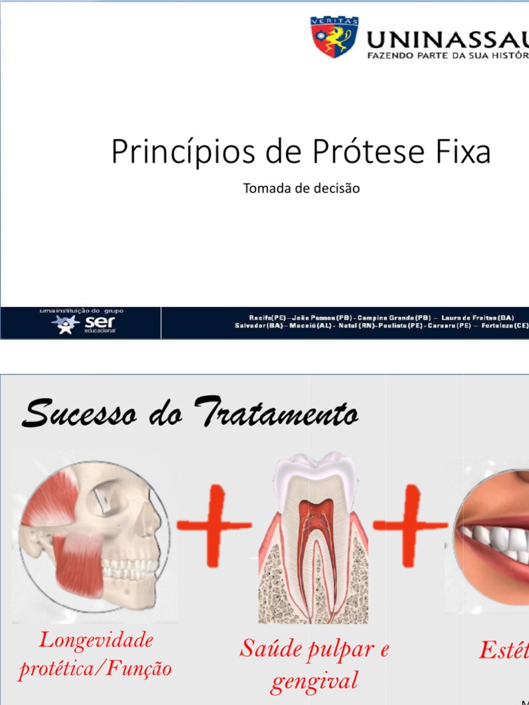 Princípios de Prótese Fixa e Retenção | PDF | Dente | Prótese