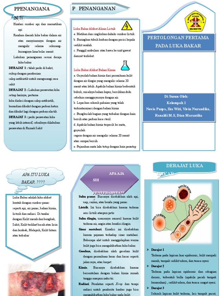 Leaflet Luka Bakar | PDF