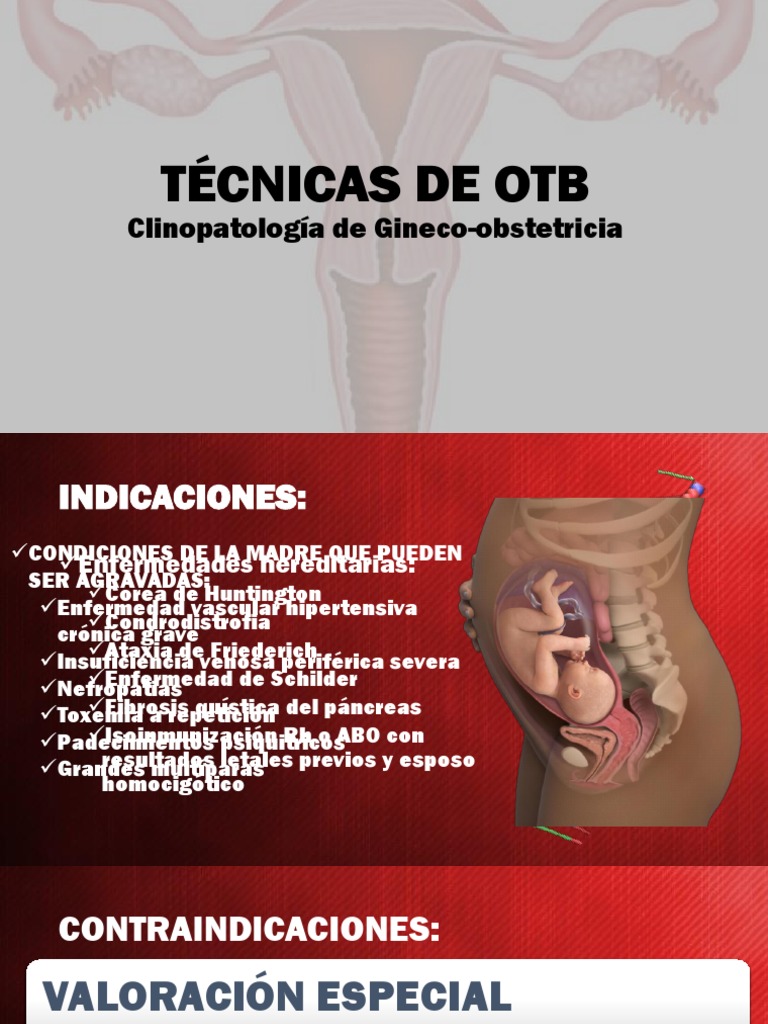 Técnicas OTB | El embarazo | Medicina