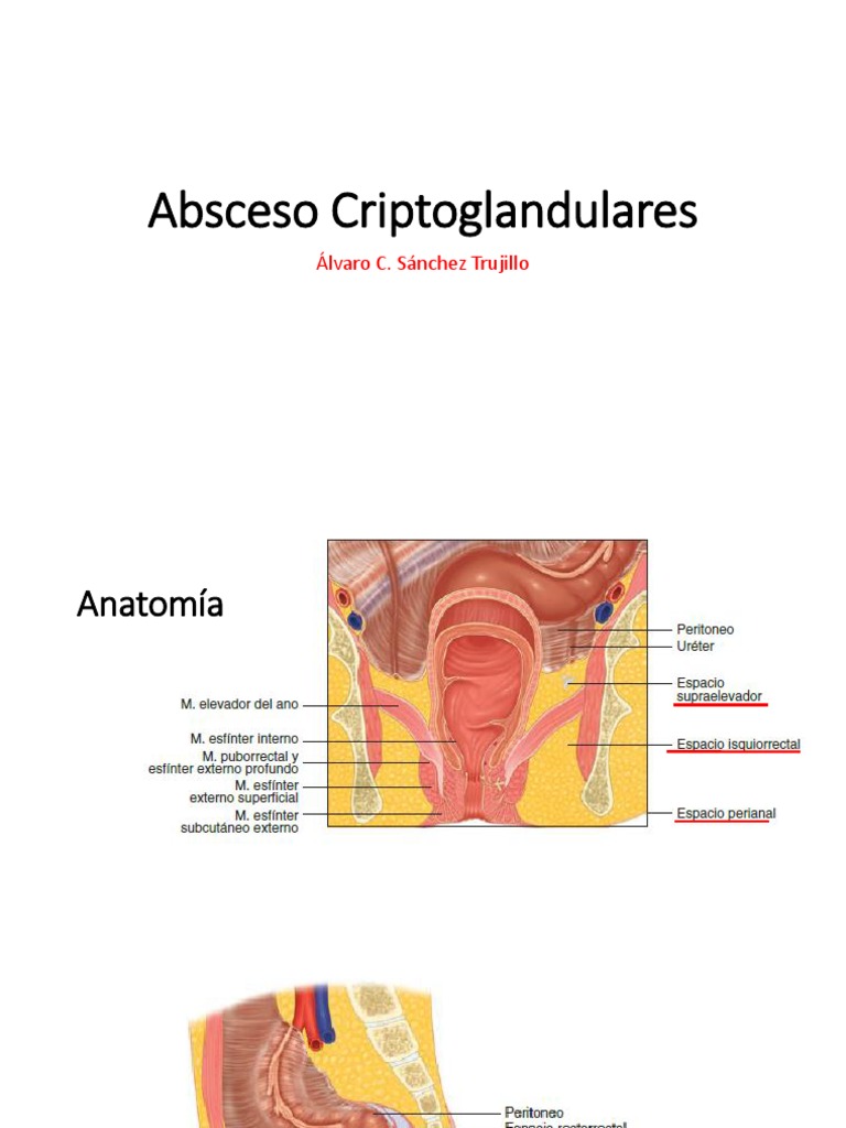 Absceso Criptoglandulares Sepsis Anorrectal | PDF