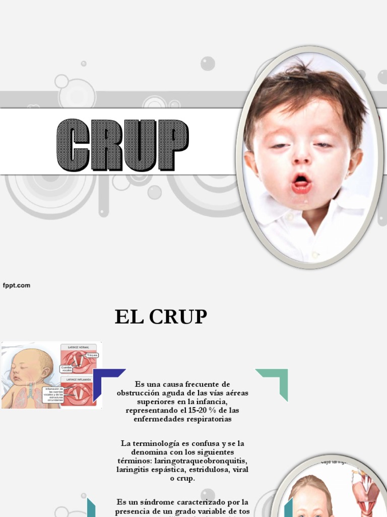 Crup 2 | PDF | Tos | Medicina CLINICA