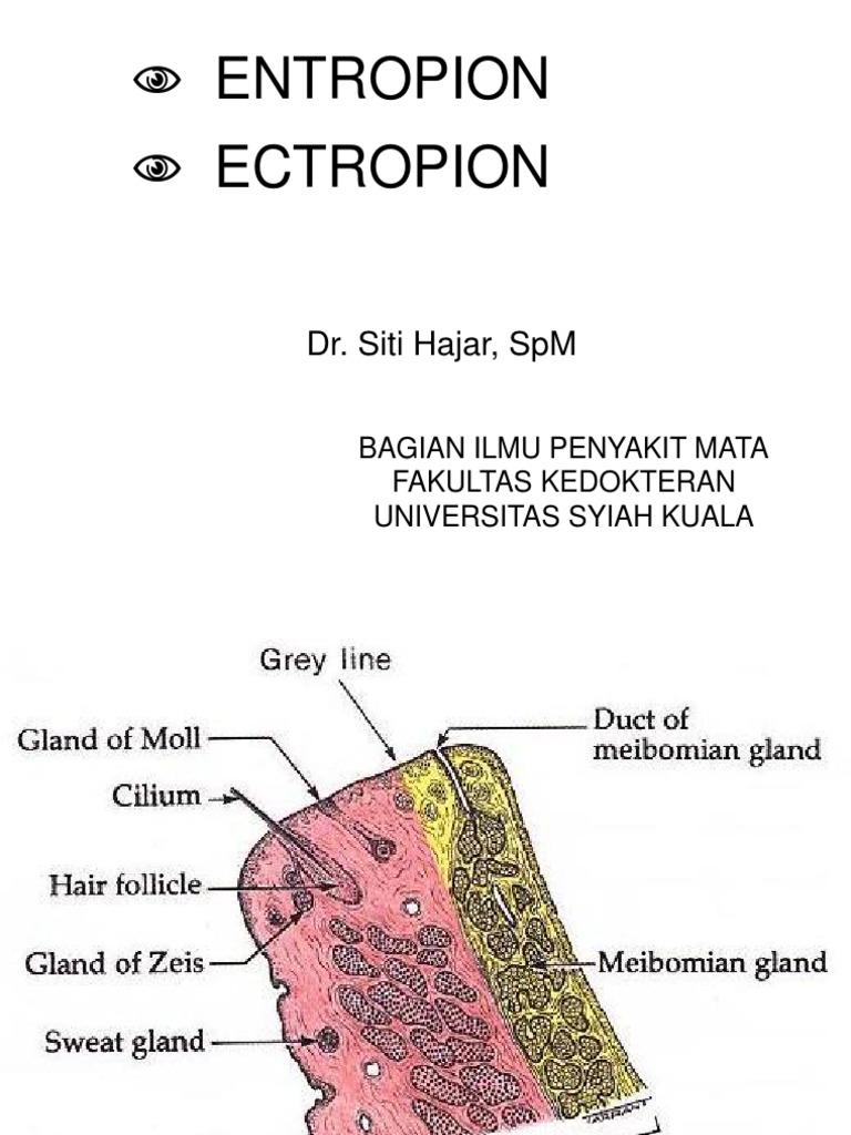 5 Entropion, Ektropion | PDF