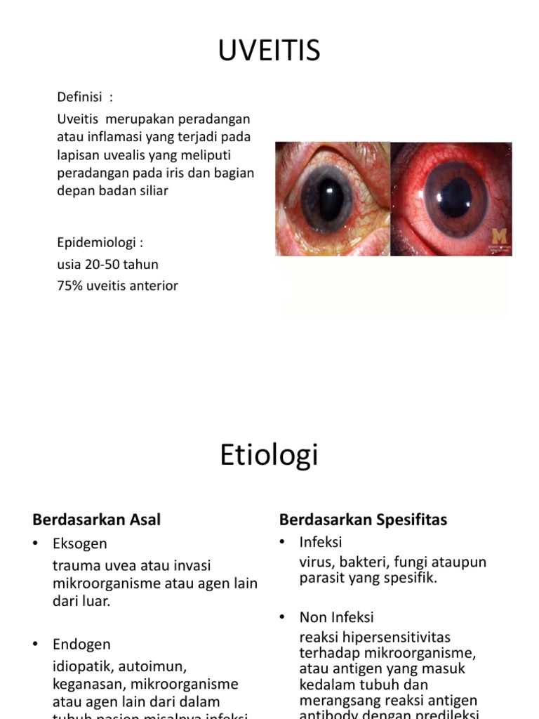 PATOFISIOLOGI DAN GEJALA KLINIS UVEITIS | PDF