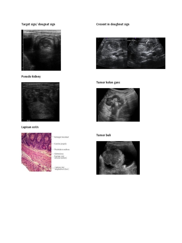 Target Sign/ Dougnat Sign Cresent in Doughnut Sign | PDF