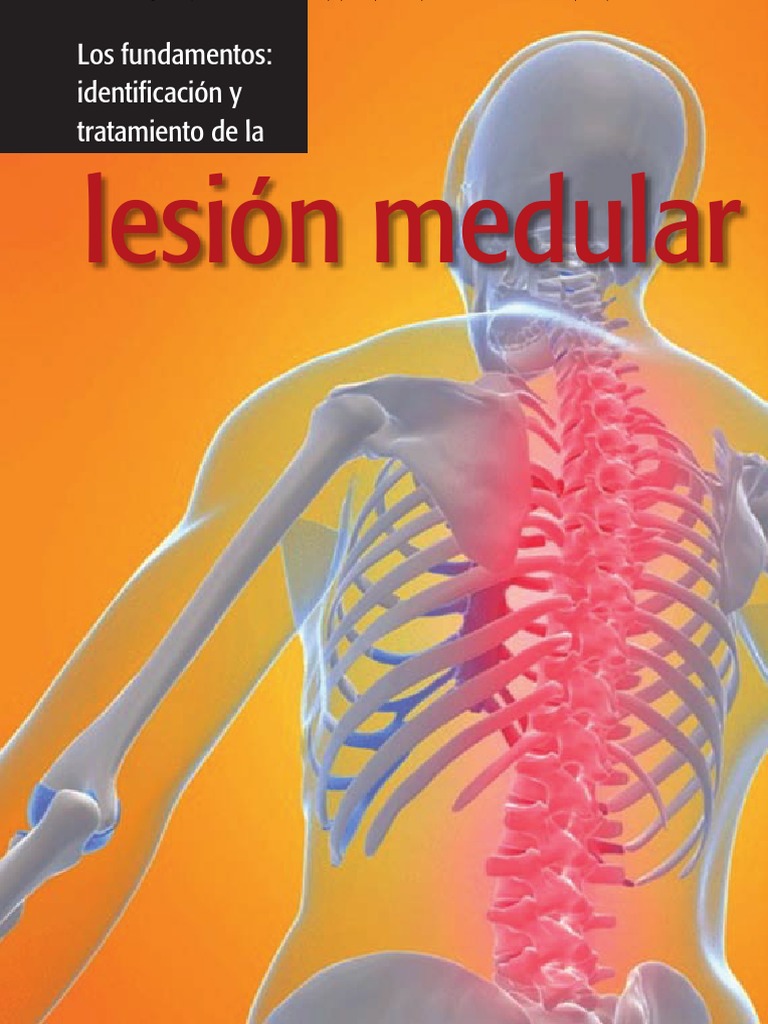 Lesión Medular | Médula espinal | Lesión