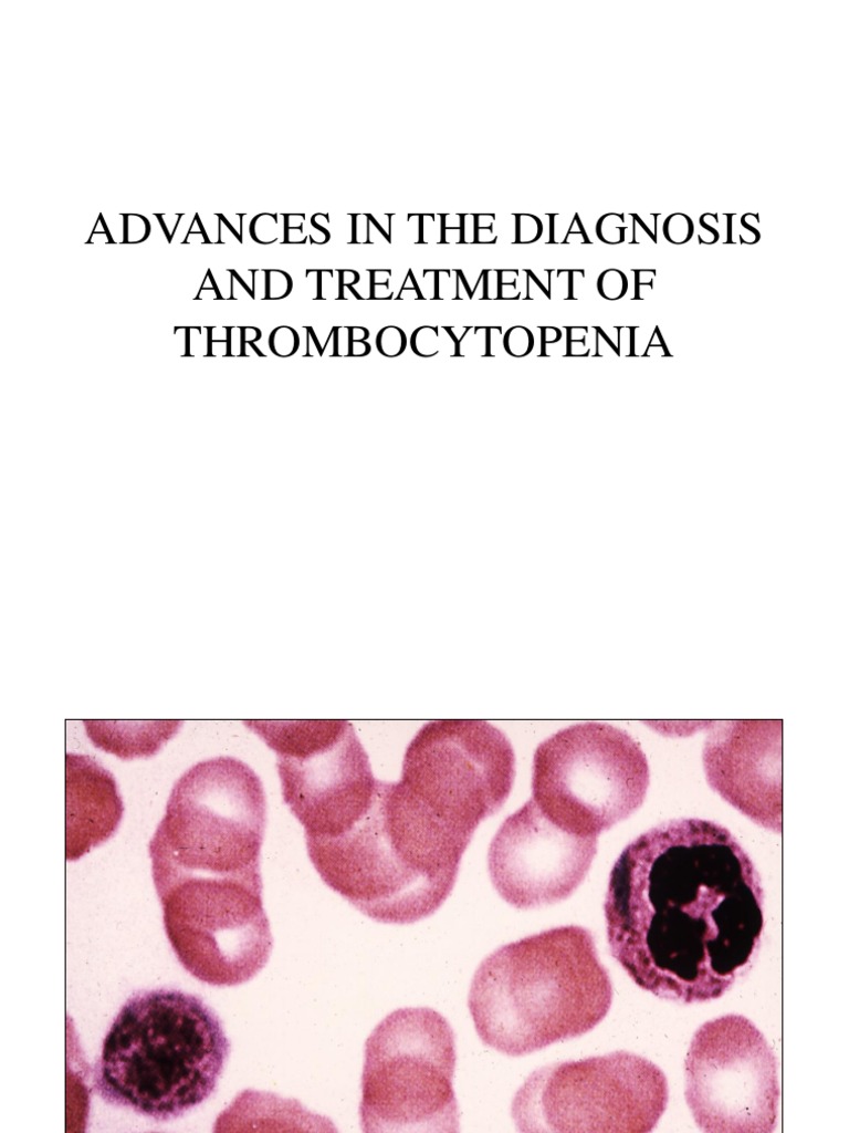 Advances in The Diagnosis and Treatment of Thrombocytopenia | PDF ...