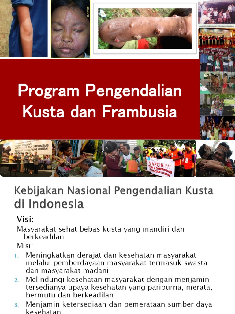 Frambusia | PDF