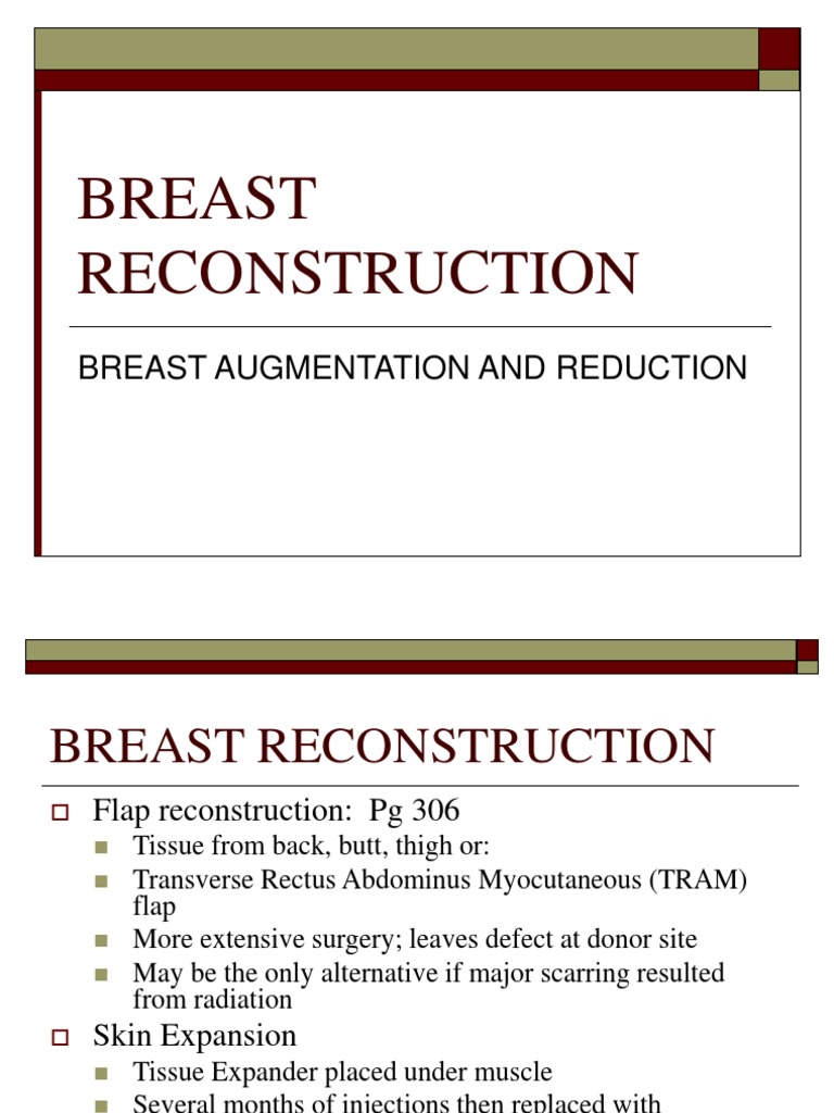 Breast Reconstruction Overview and Techniques | PDF