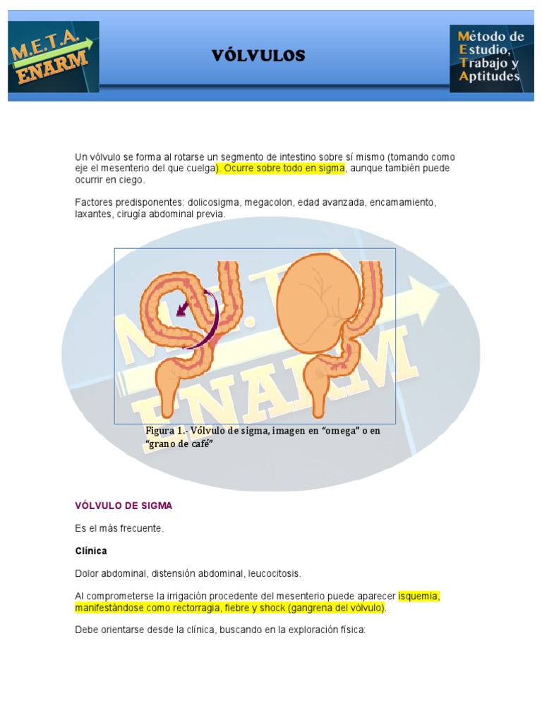 Vólvulo de Sigma y Ciego: Diagnóstico y Tratamiento | PDF | Abdomen ...