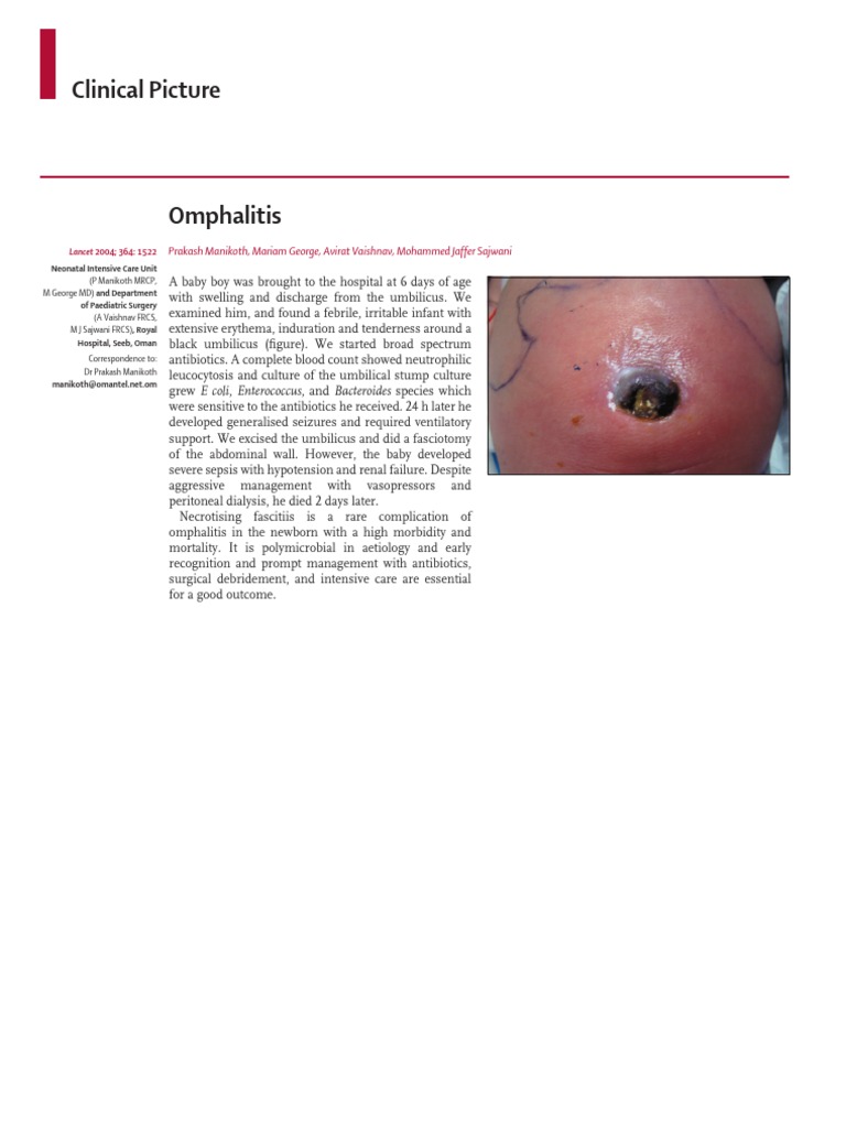 Omphalitis in Newborns: A Case Study | PDF | Science & Mathematics