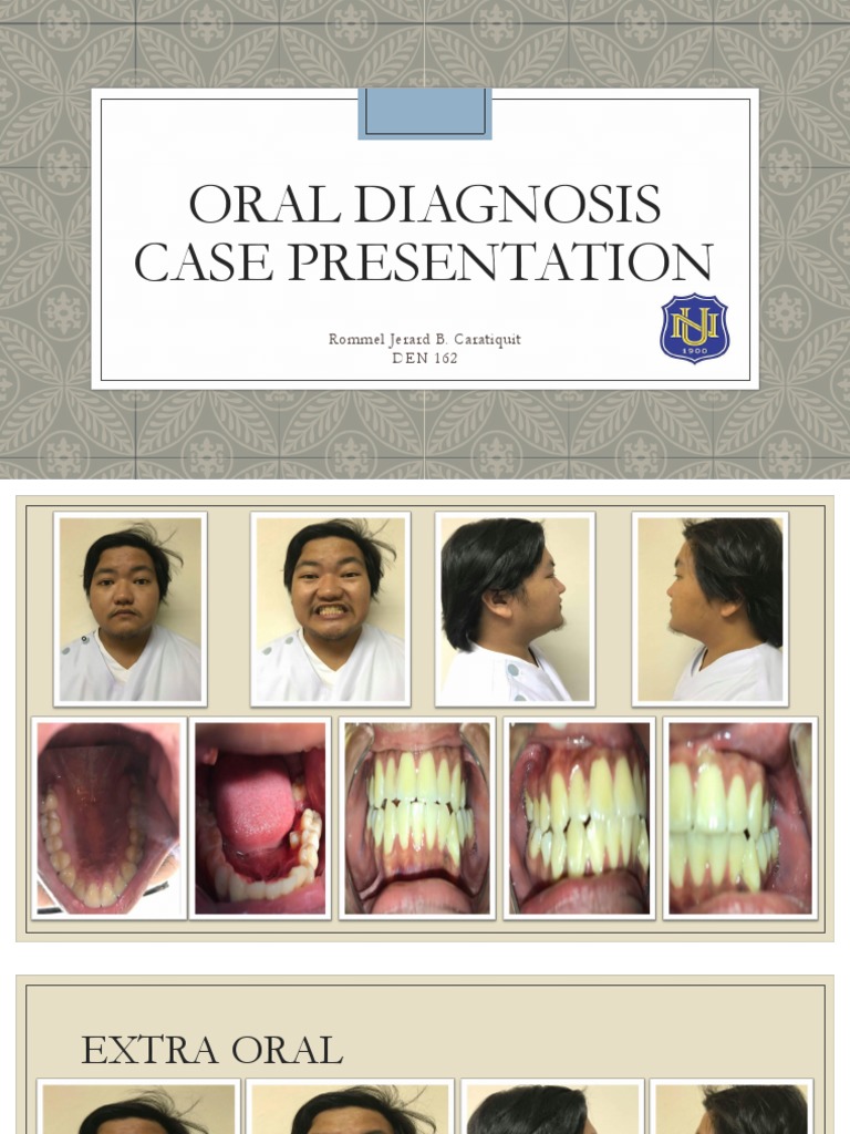 Oral Diagnosis Case Presentation: Rommel Jerard B. Caratiquit DEN 162 ...