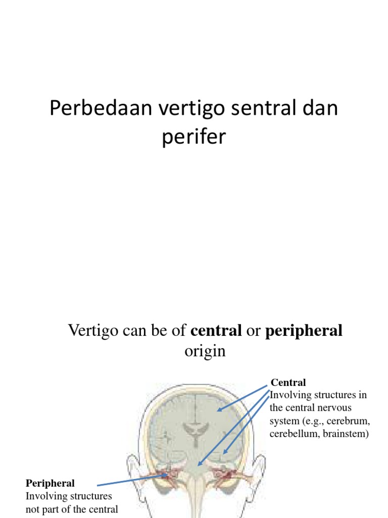 Perbedaan Vertigo Sentral Dan Perifer | PDF | Vertigo | Medical Specialties