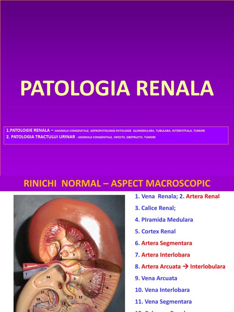 Patología Renal: Anomalías y Nefropatías | PDF