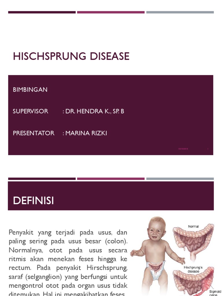 Hisprung Disease | PDF