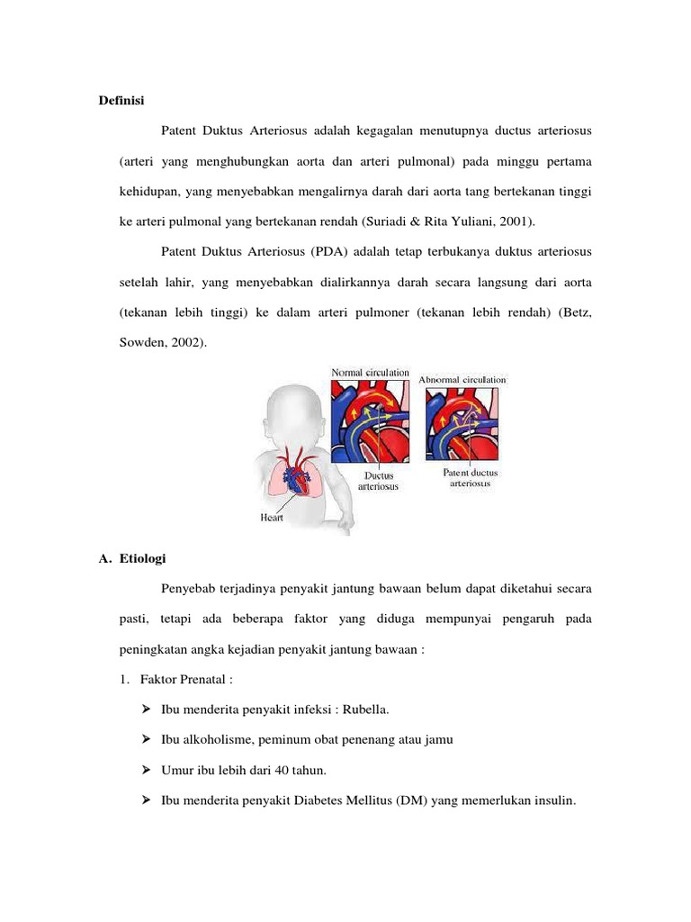 Pemahaman Patent Duktus Arteriosus (PDA) | PDF | Kesehatan Holistik