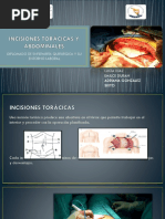 Incisión de McBurney y Anestesia Regional | PDF | Anestesia | Cirugía