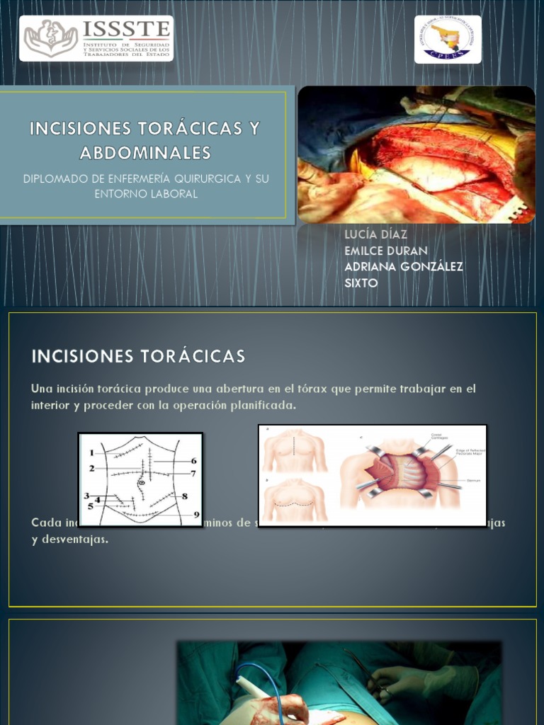 Incisiones Toracicas y Abdominales | PDF | Cirugía de bypass de la ...