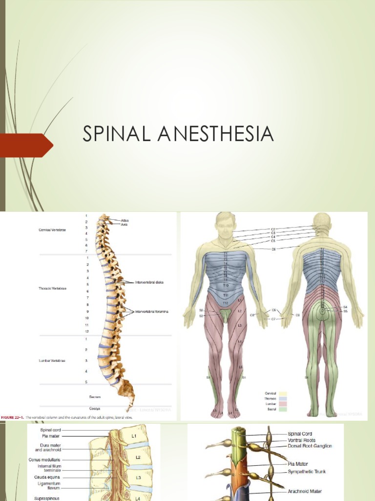 Spinal Anesthesia: Physiology and Techniques | PDF