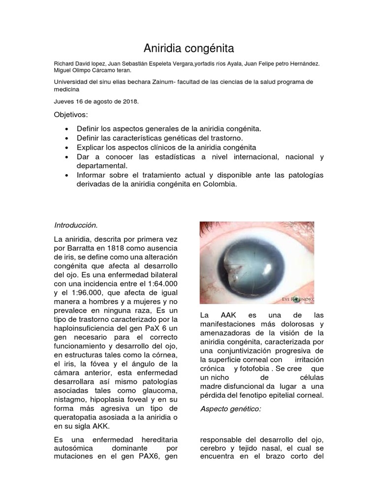 Aniridia Congénita: Definición y Tratamiento | PDF | Córnea | Medicina ...