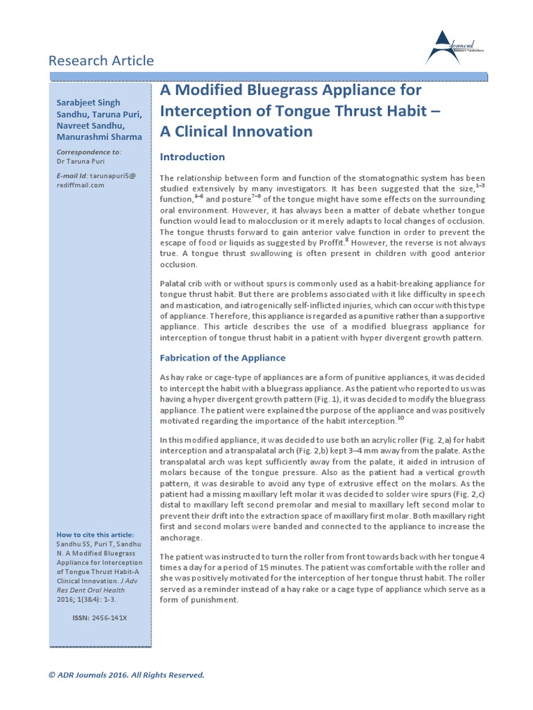 A Modified Bluegrass Appliance For Interception of Tongue Thrust Habit ...