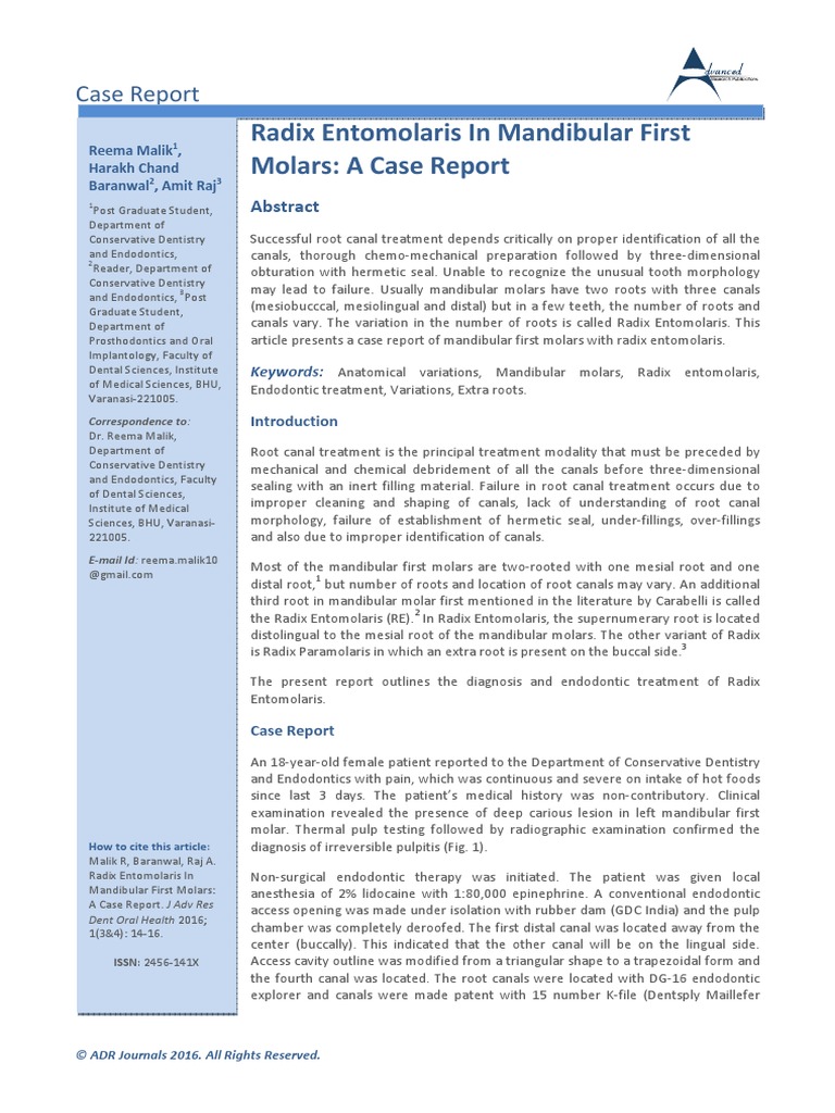 Radix Entomolaris in Mandibular First Molars: A Case Report | PDF ...