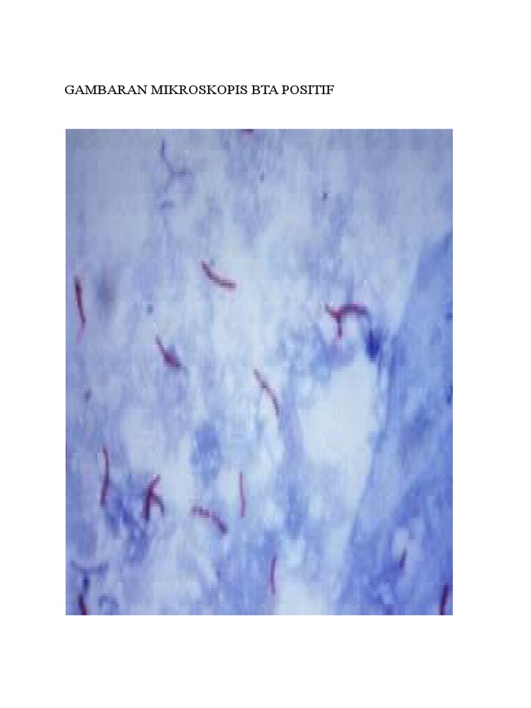 Gambaran Mikroskopis Bta Positif | PDF