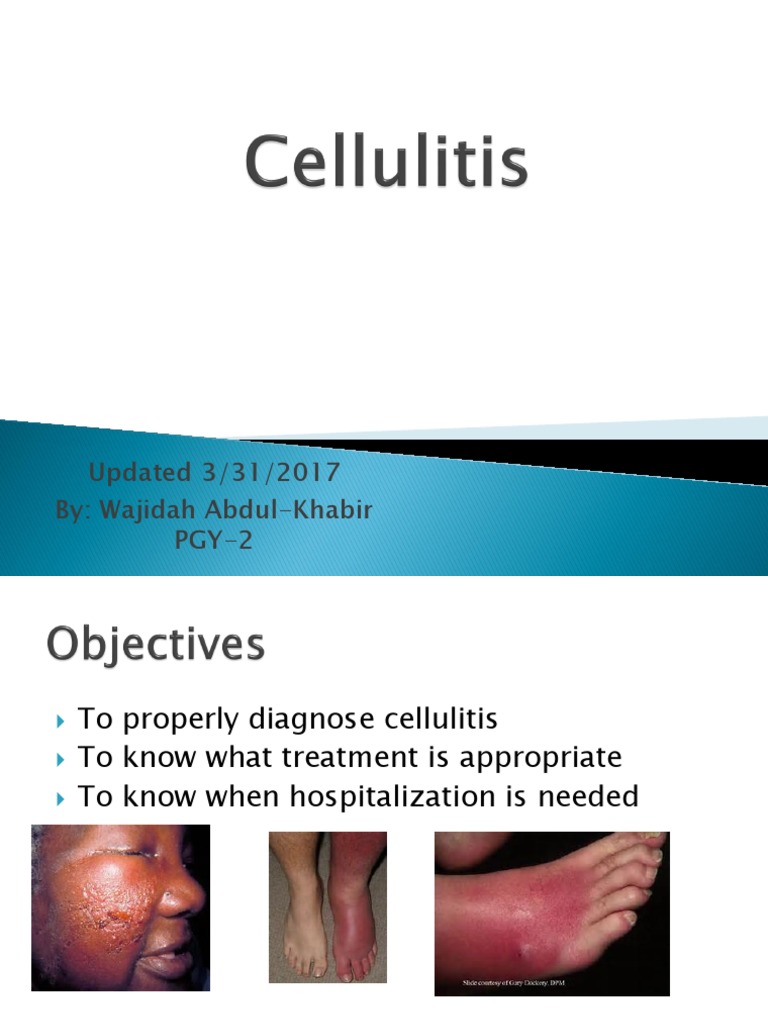 Cellulitis | PDF | Methicillin Resistant Staphylococcus Aureus | Infection