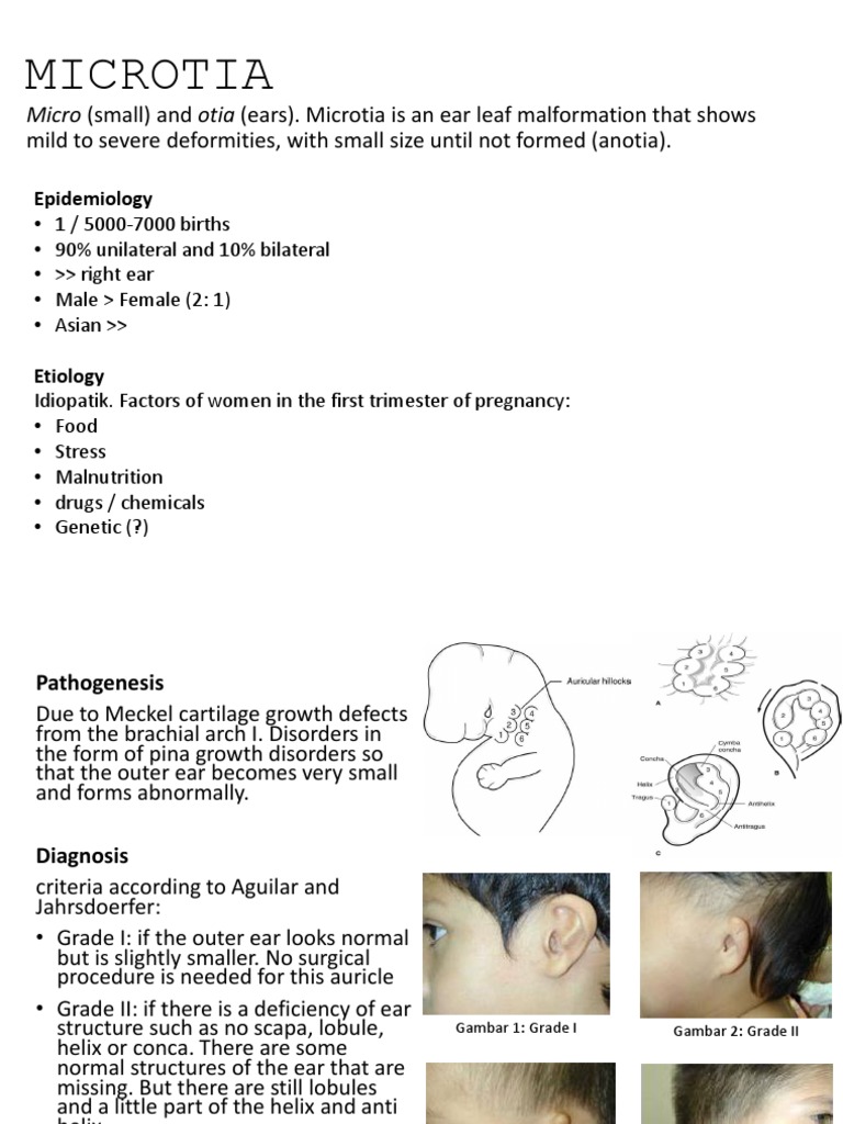 Microtia: Micro (Small) and Otia (Ears) - Microtia Is An Ear Leaf ...