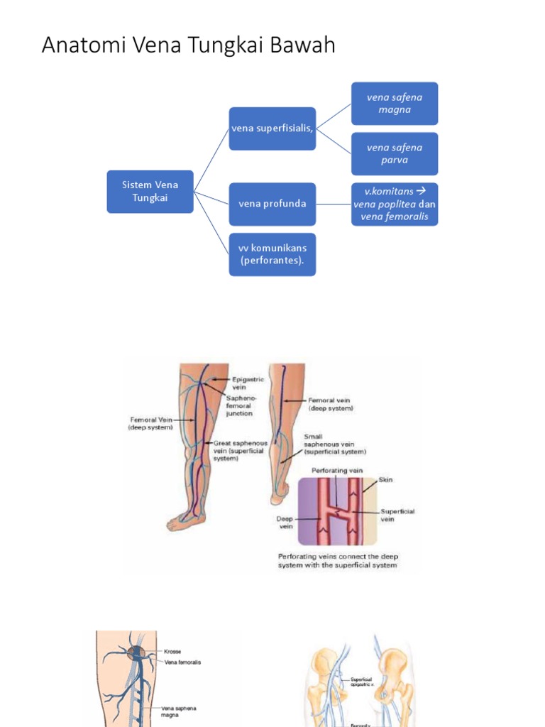 Varises Vena Tungkai Bawah | PDF