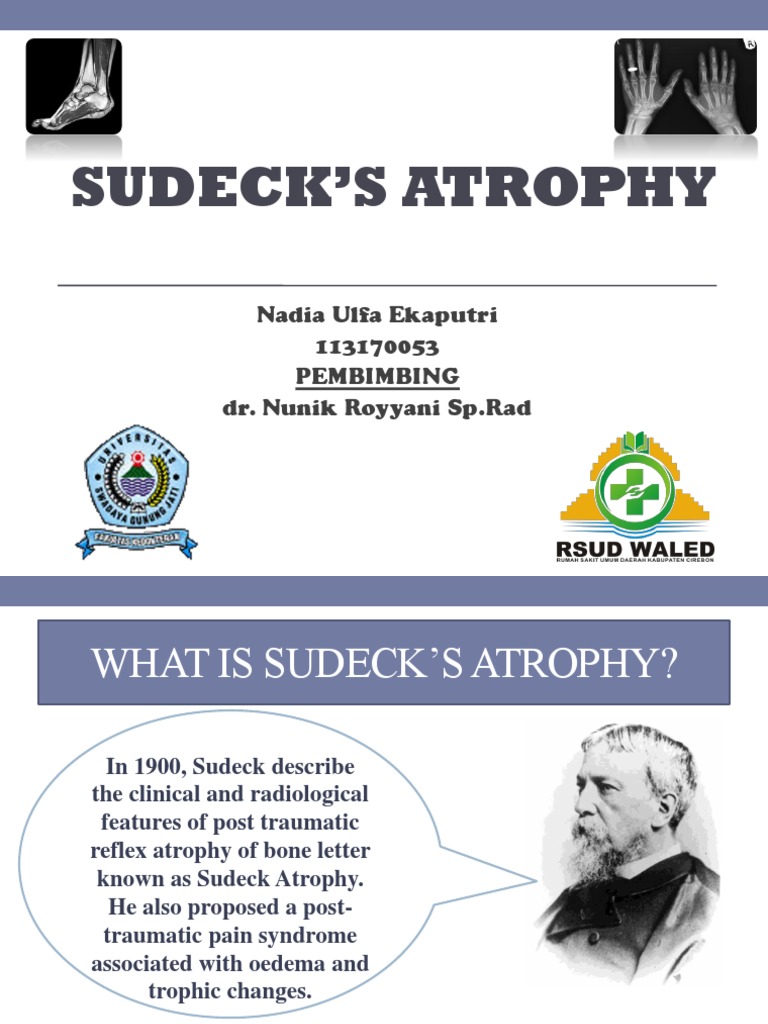 Sudeck's Atrophy | PDF | Musculoskeletal System | Clinical Medicine