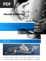Vacuum Delivery: Procedure and Complications | PDF