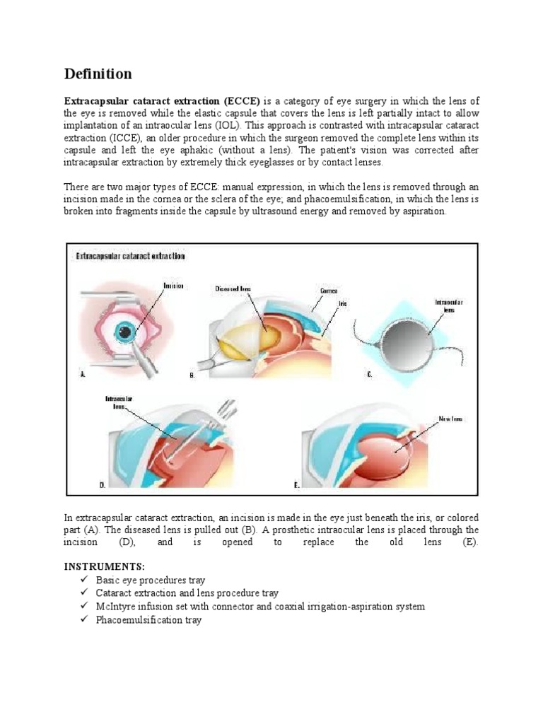 Cataract Extraction | PDF | Ophthalmology | Medical Specialties