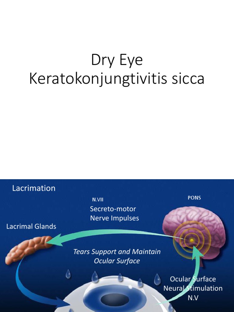 Dry Eye | PDF | Ophthalmology | Medical Specialties