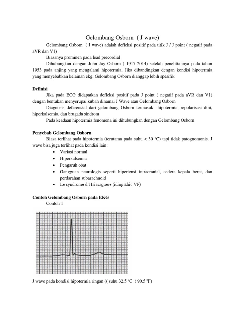 Gelombang Osborn | PDF