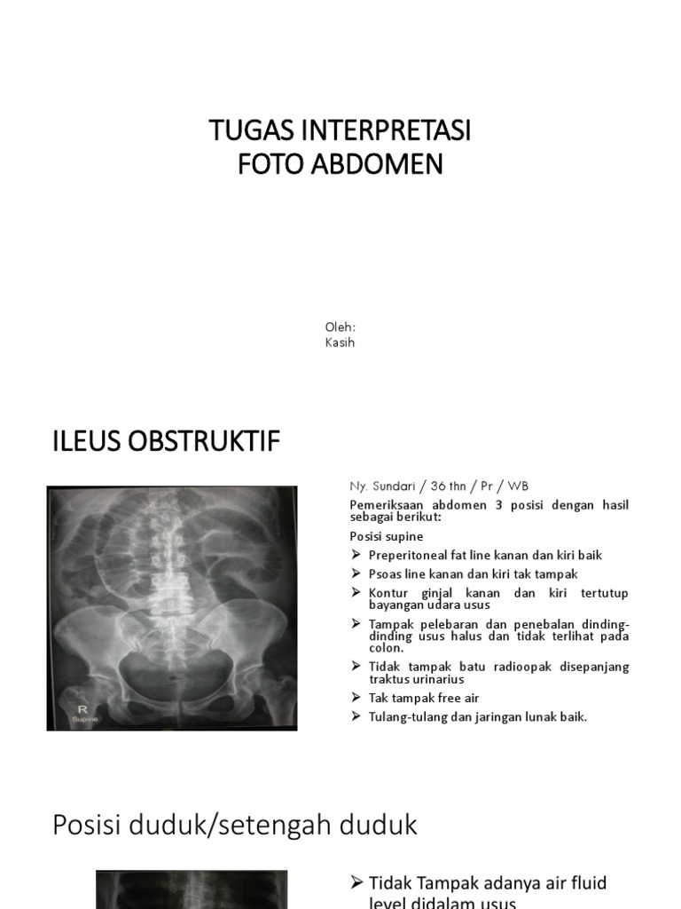 Interpretasi Rontgen Abdomen Ileus | PDF | Kesehatan Holistik | Sains ...