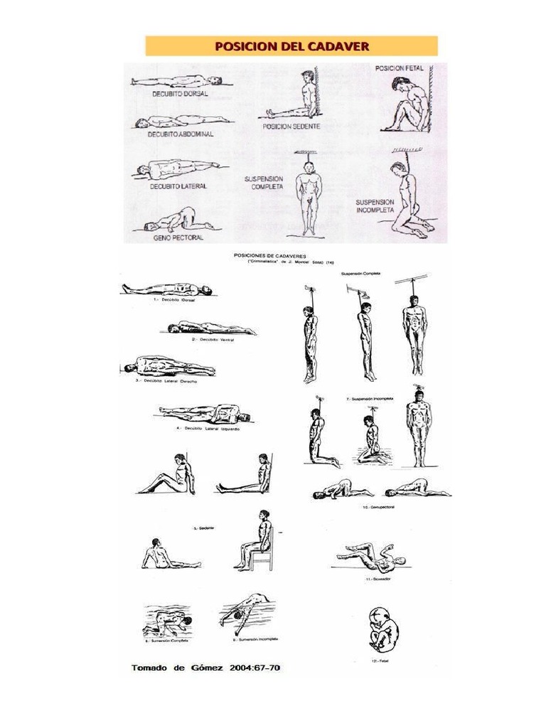 Posiciones de Cadaver IC | PDF